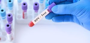 HPV-Test: Ablauf, Kosten und Risiken auf einen Blick